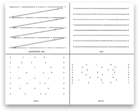 New Information on Vision and Concussion - Lynn Hellerstein